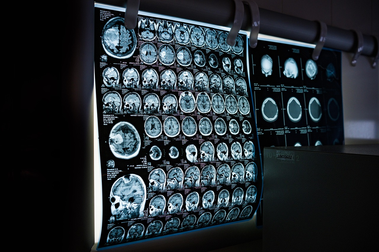 Radiology RVU Calculator — Free wRVU Productivity Tool | RadCore